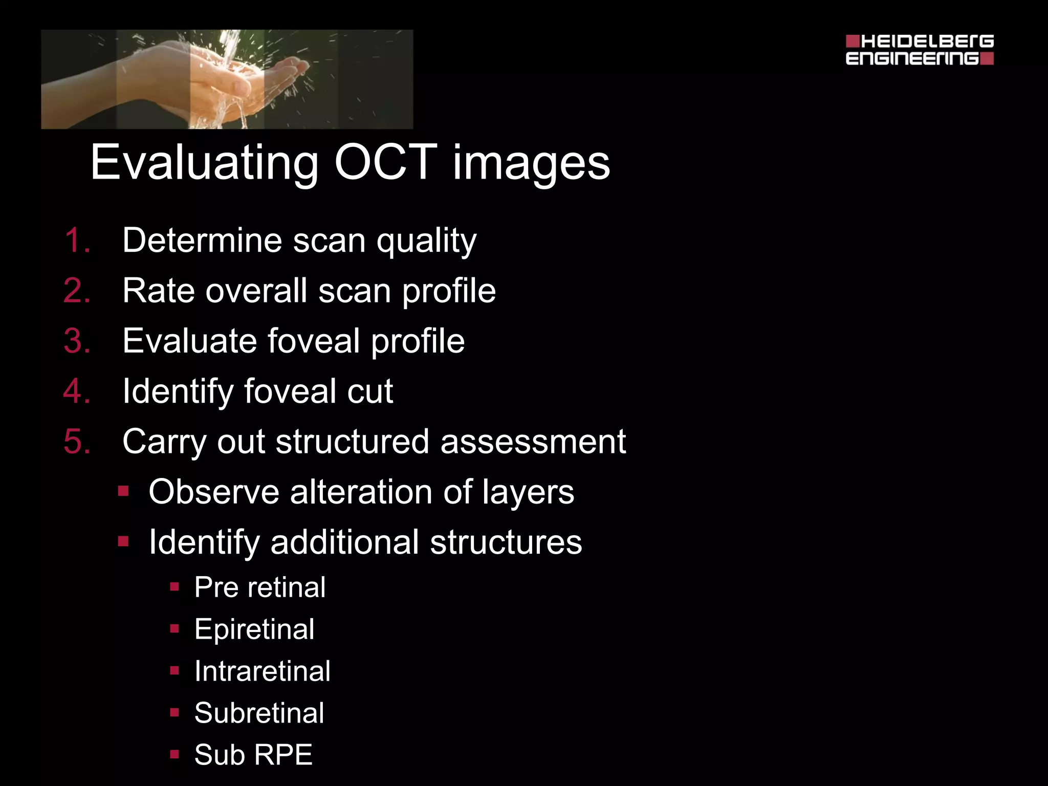 Spectralis oct normal anatomy & systematic interpretation. | PDF
