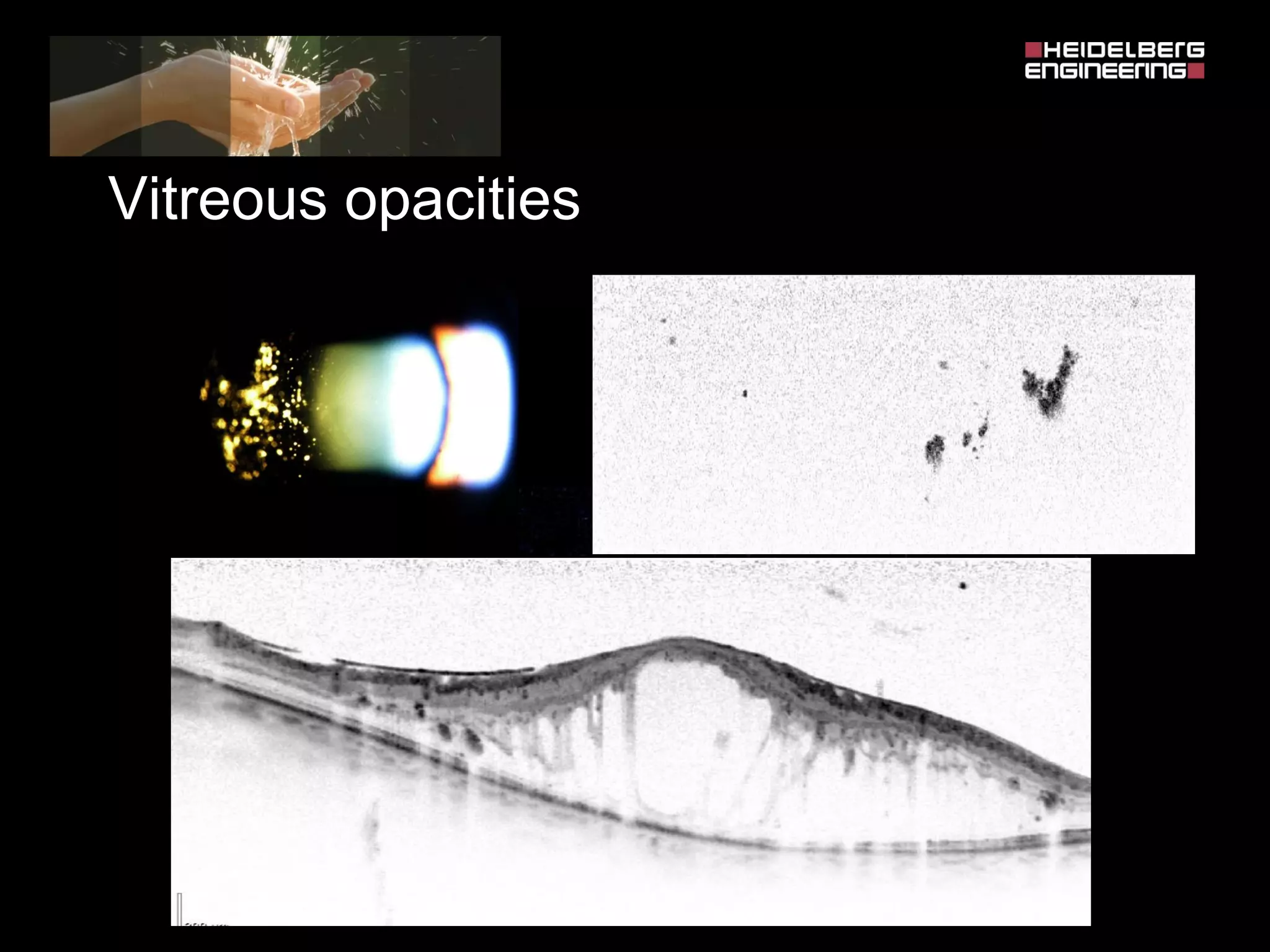 Spectralis oct normal anatomy & systematic interpretation. | PDF