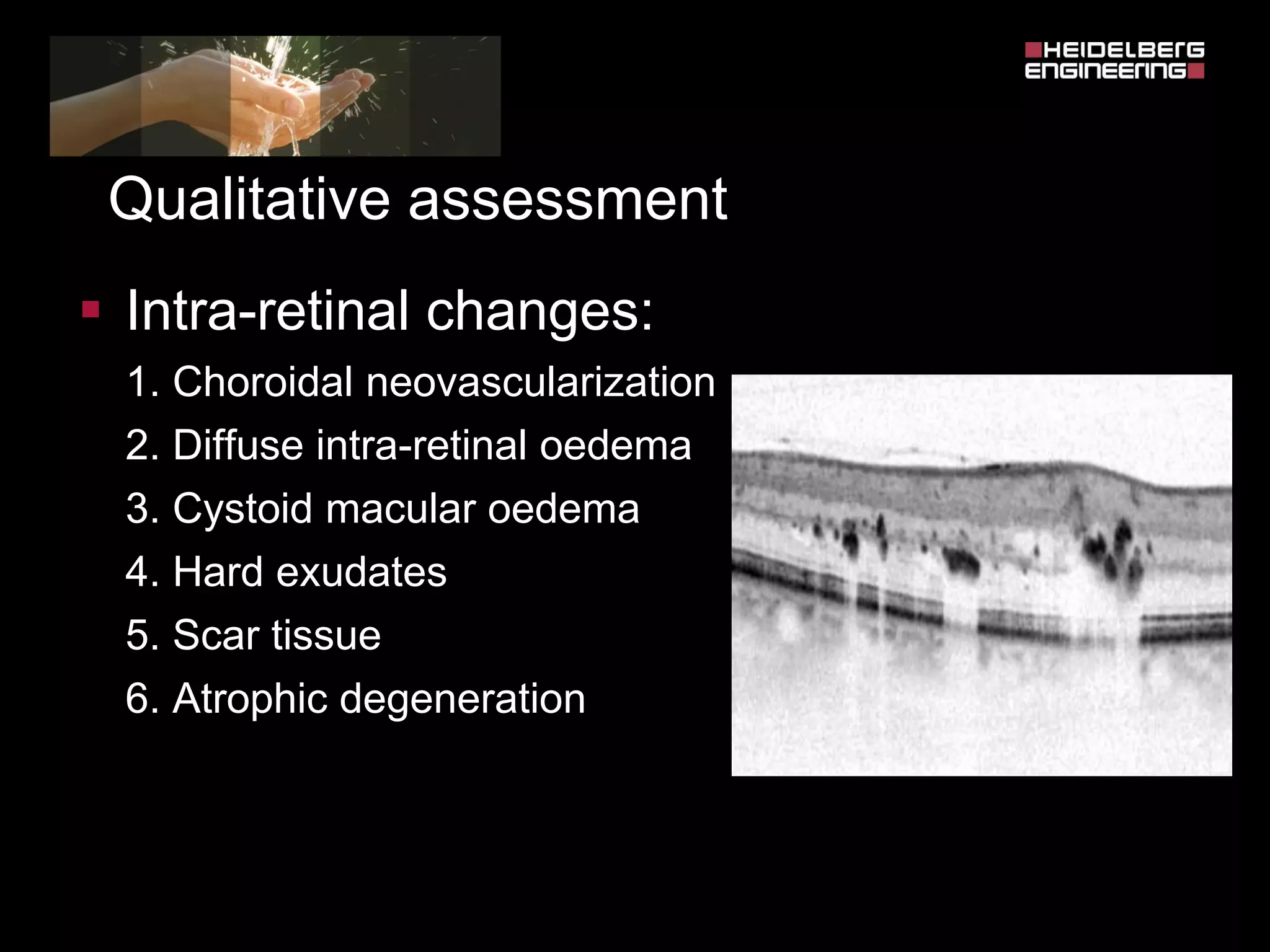 Spectralis oct normal anatomy & systematic interpretation. | PDF
