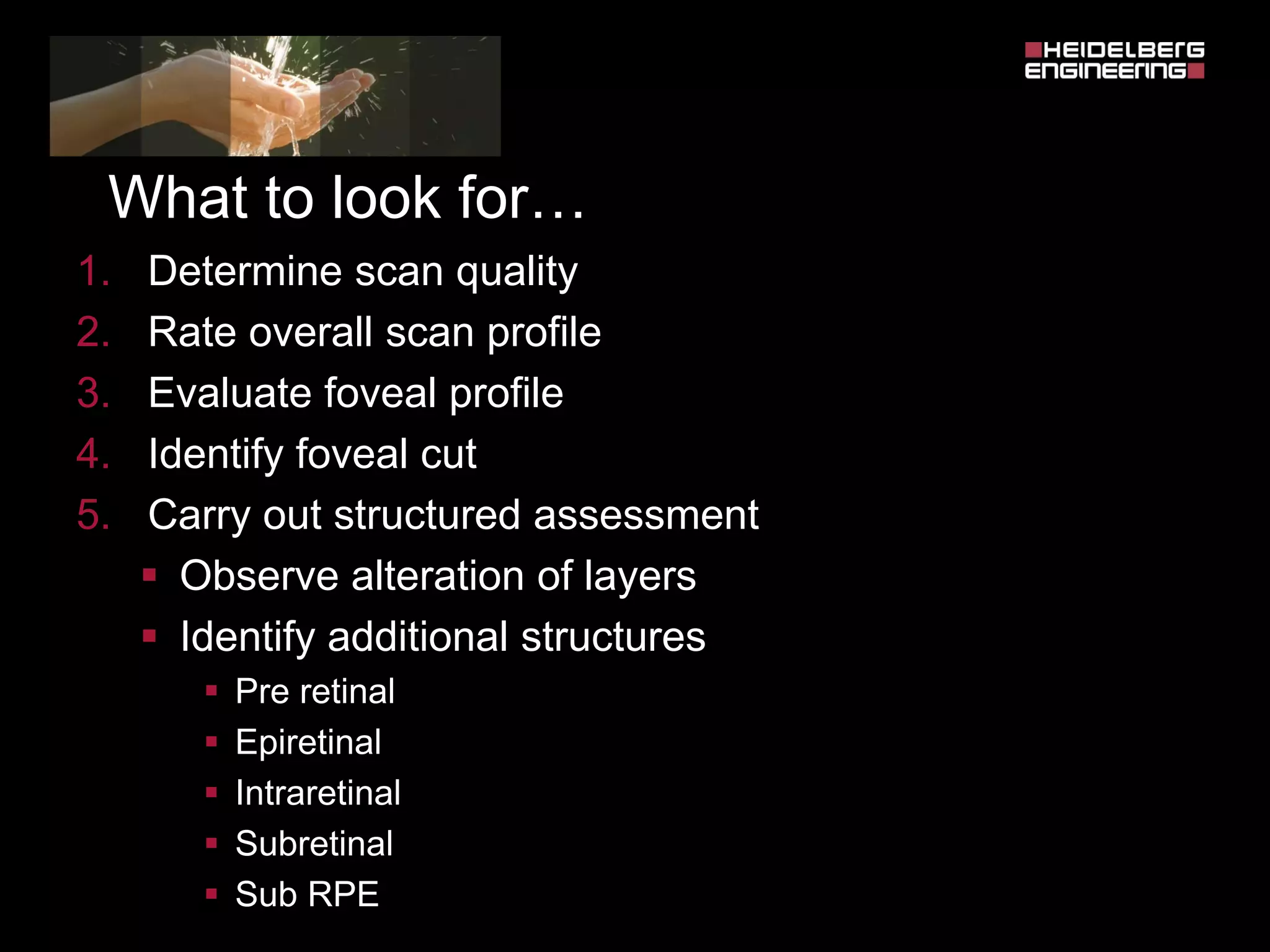 Spectralis oct normal anatomy & systematic interpretation. | PDF