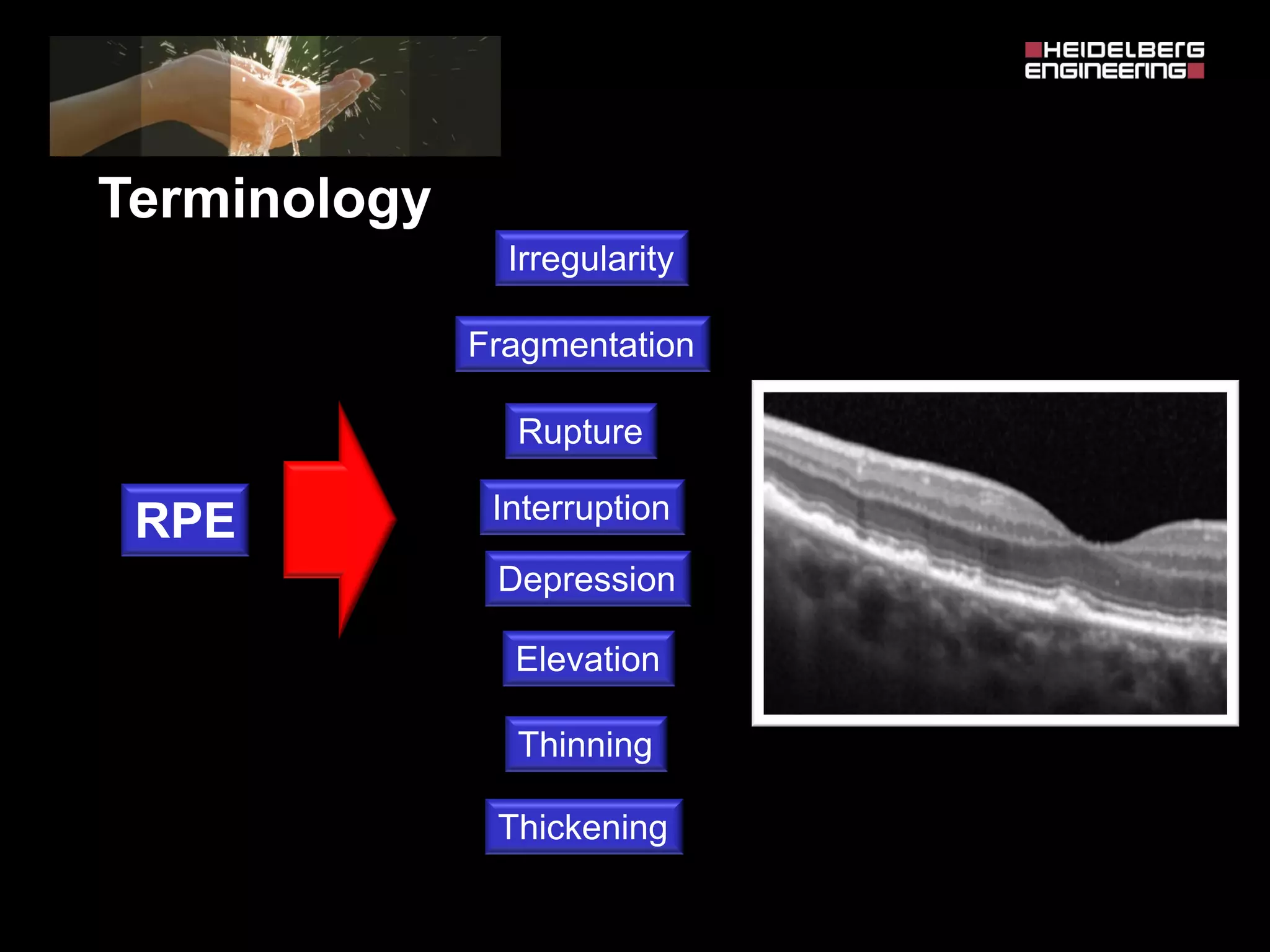 Spectralis oct normal anatomy & systematic interpretation. | PDF