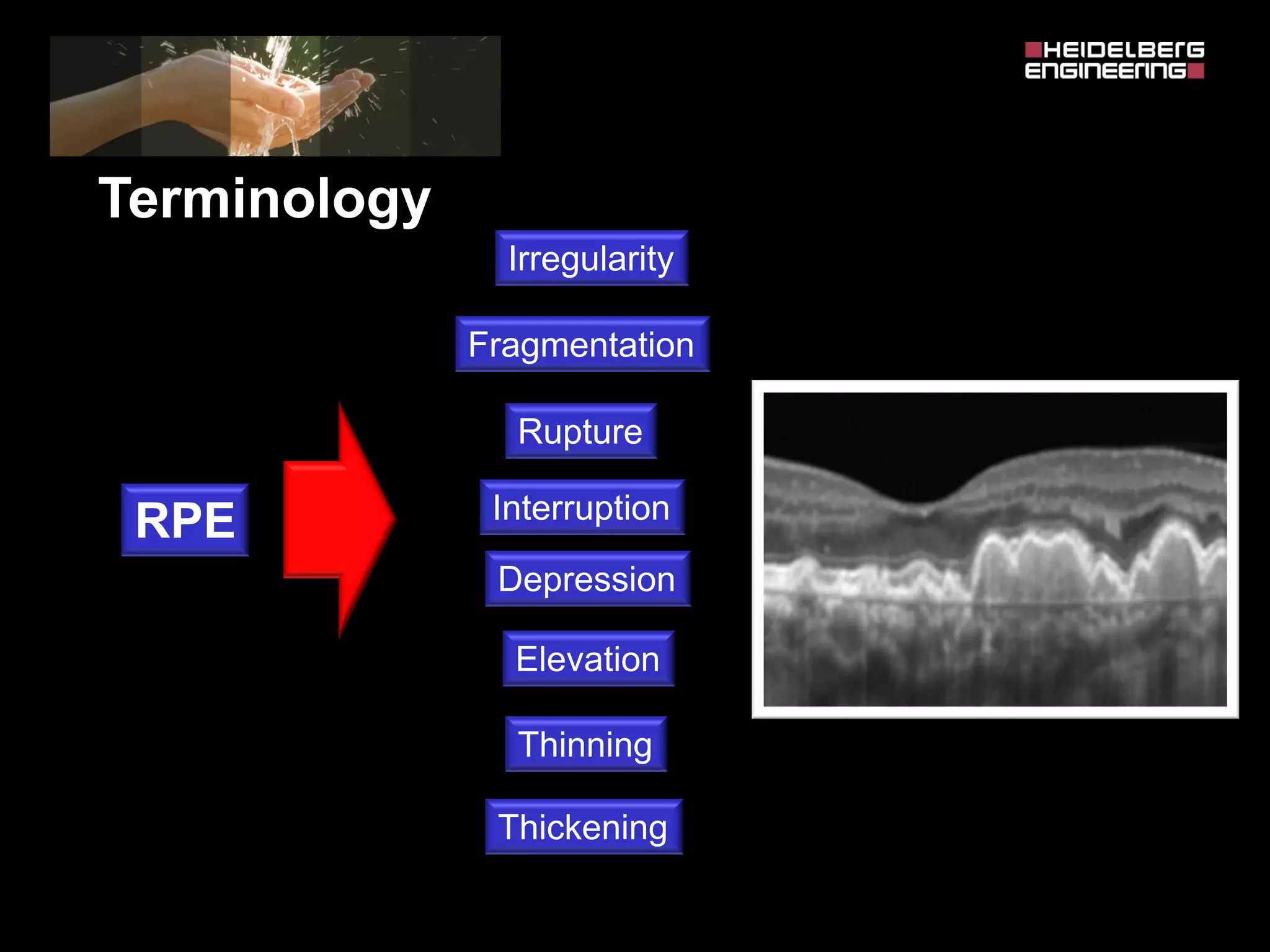 Spectralis oct normal anatomy & systematic interpretation. | PDF