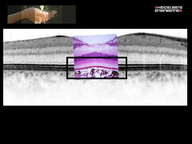 Spectralis oct normal anatomy & systematic interpretation. | PDF | Eye ...