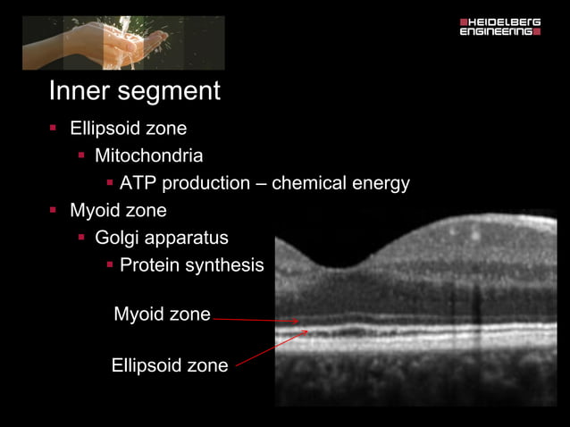 Spectralis oct normal anatomy & systematic interpretation. | PDF | Eye ...