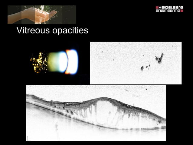 Spectralis oct normal anatomy & systematic interpretation. | PDF | Eye ...