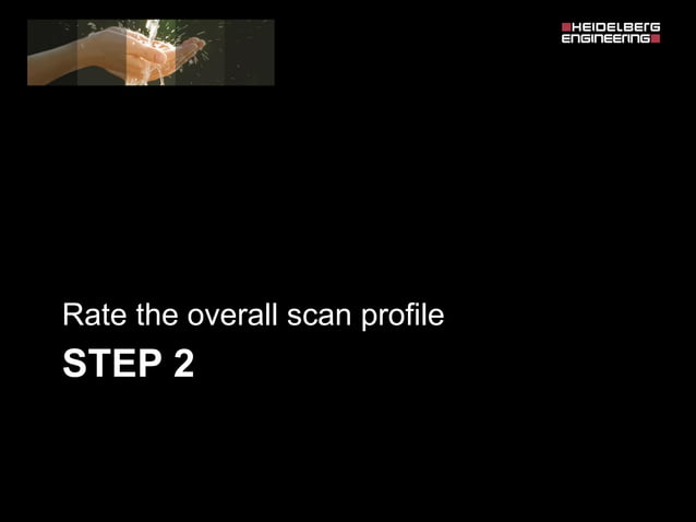 Spectralis oct normal anatomy & systematic interpretation. | PDF | Eye ...