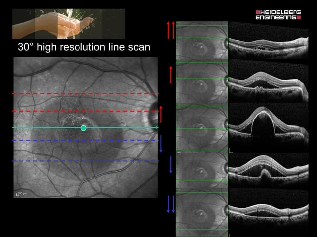 Spectralis oct normal anatomy & systematic interpretation. | PDF | Eye ...