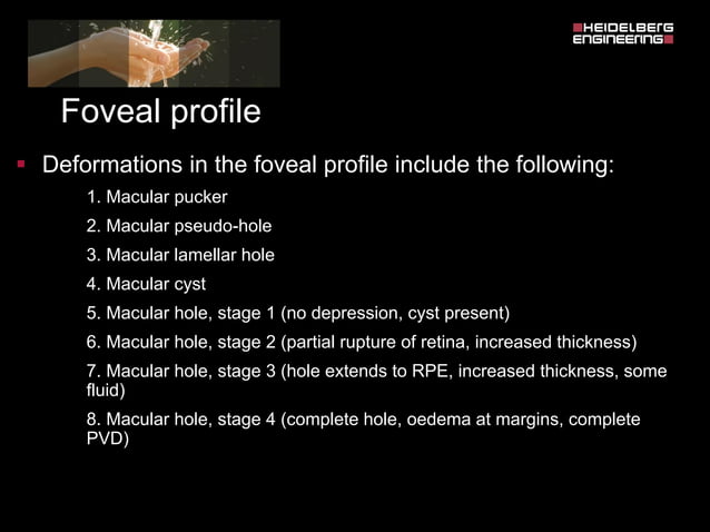 Spectralis oct normal anatomy & systematic interpretation. | PDF | Eye ...