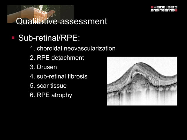 Spectralis oct normal anatomy & systematic interpretation. | PDF | Eye ...