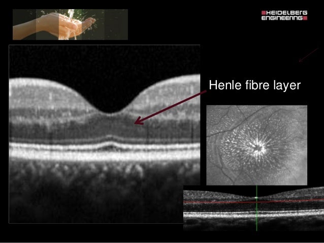 Spectralis oct normal anatomy & systematic interpretation.