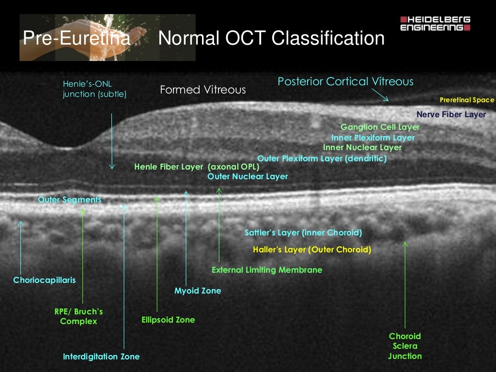 Spectralis oct normal anatomy & systematic interpretation.