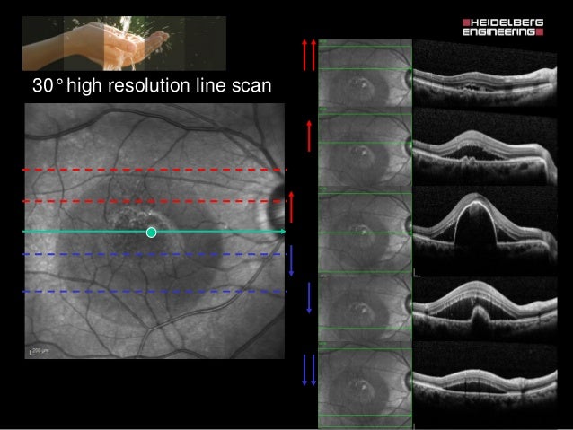 Spectralis oct normal anatomy & systematic interpretation.