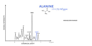 Magnetic Resonance Spectroscopy (MRS) | PDF