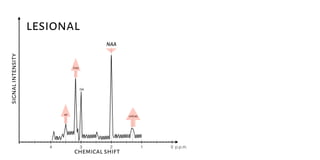 Magnetic Resonance Spectroscopy (MRS) | PDF