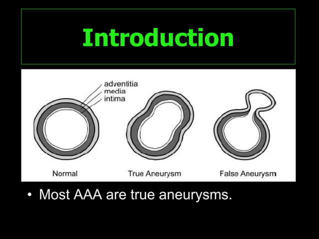 Spectrum Of Ct Findings In Rupture And Impendinging Rupture Of AAA | PPT
