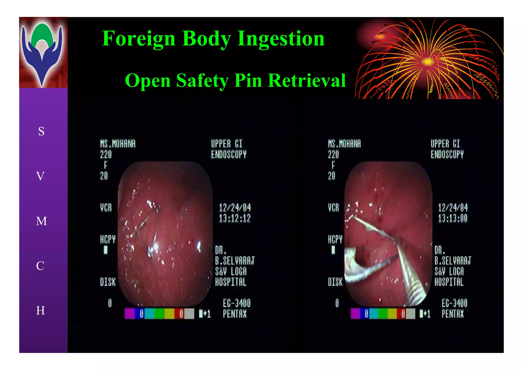 Pediatric Surgery spectrum | PDF