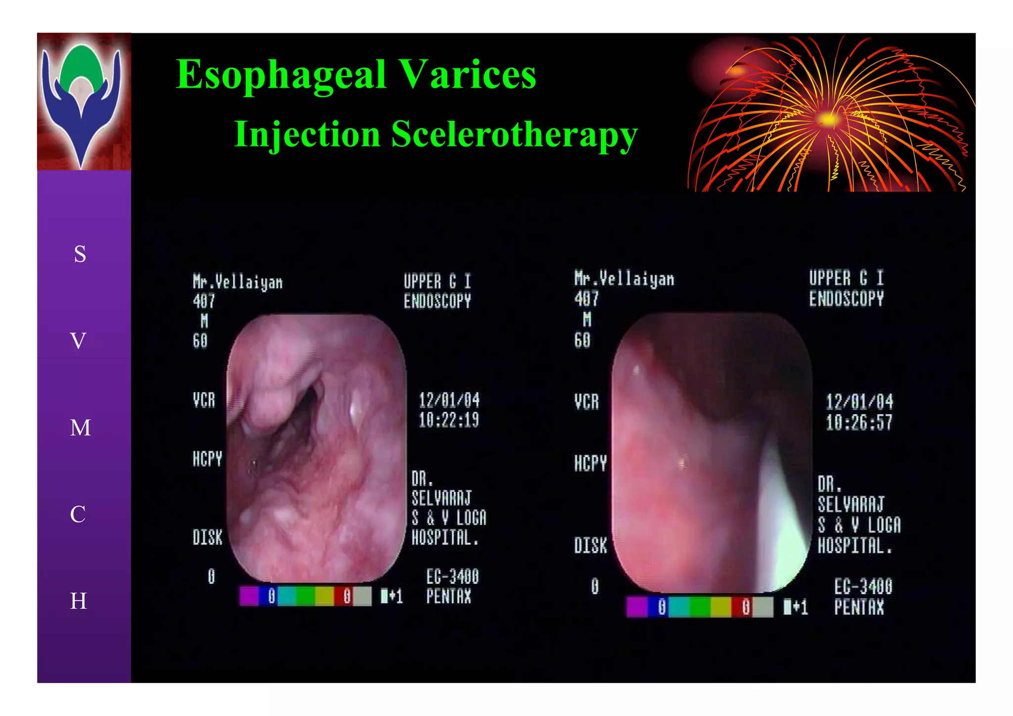 Pediatric Surgery spectrum | PDF