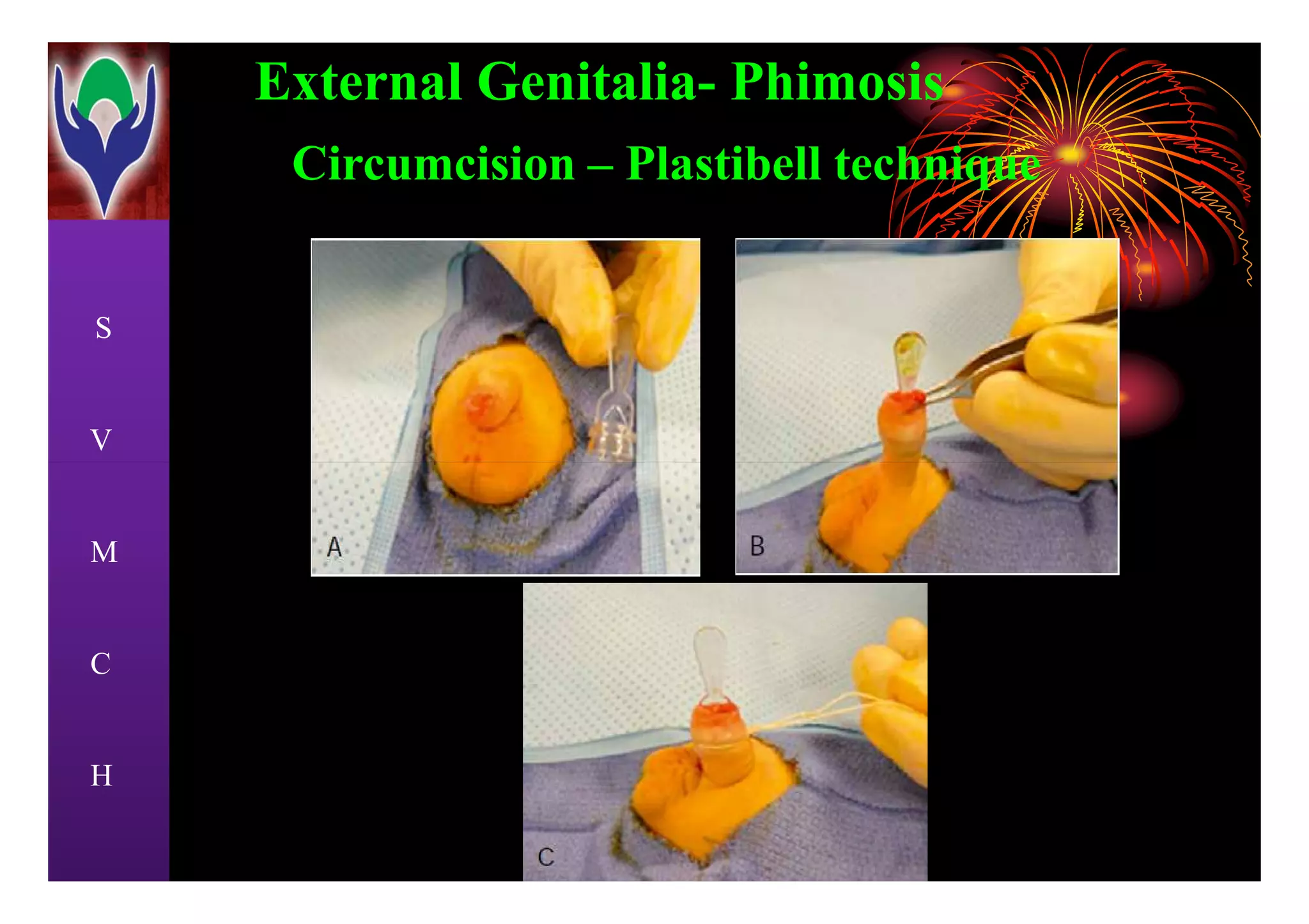 Pediatric Surgery spectrum | PPT | Free Download