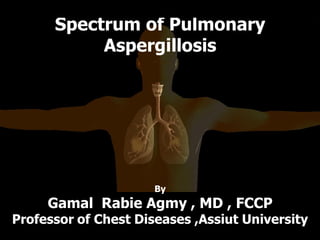Spectrum of pulmonary asperigellosis | PDF