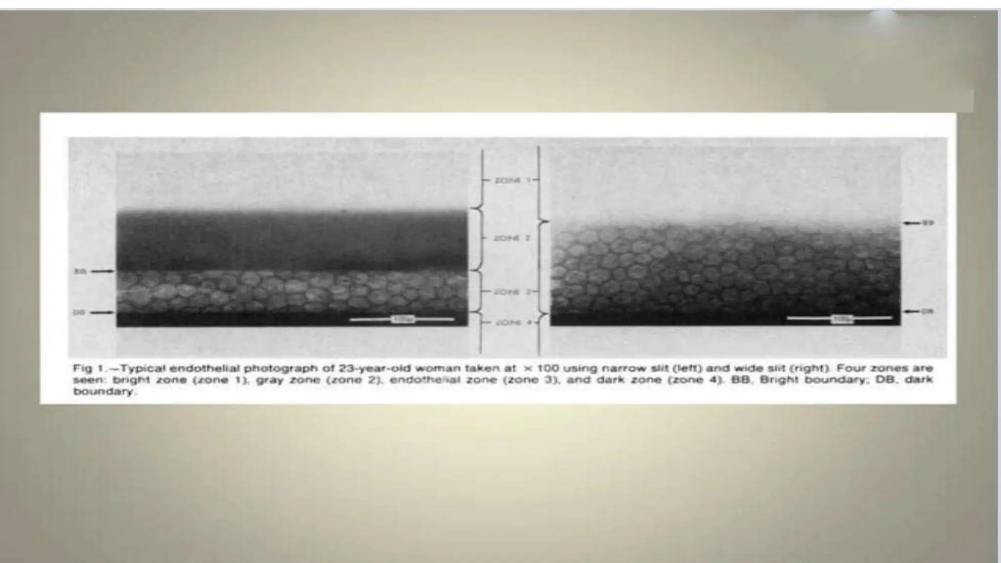 SPECULAR AND CONFOCAL MICROSCOPY IN EYE.pptx