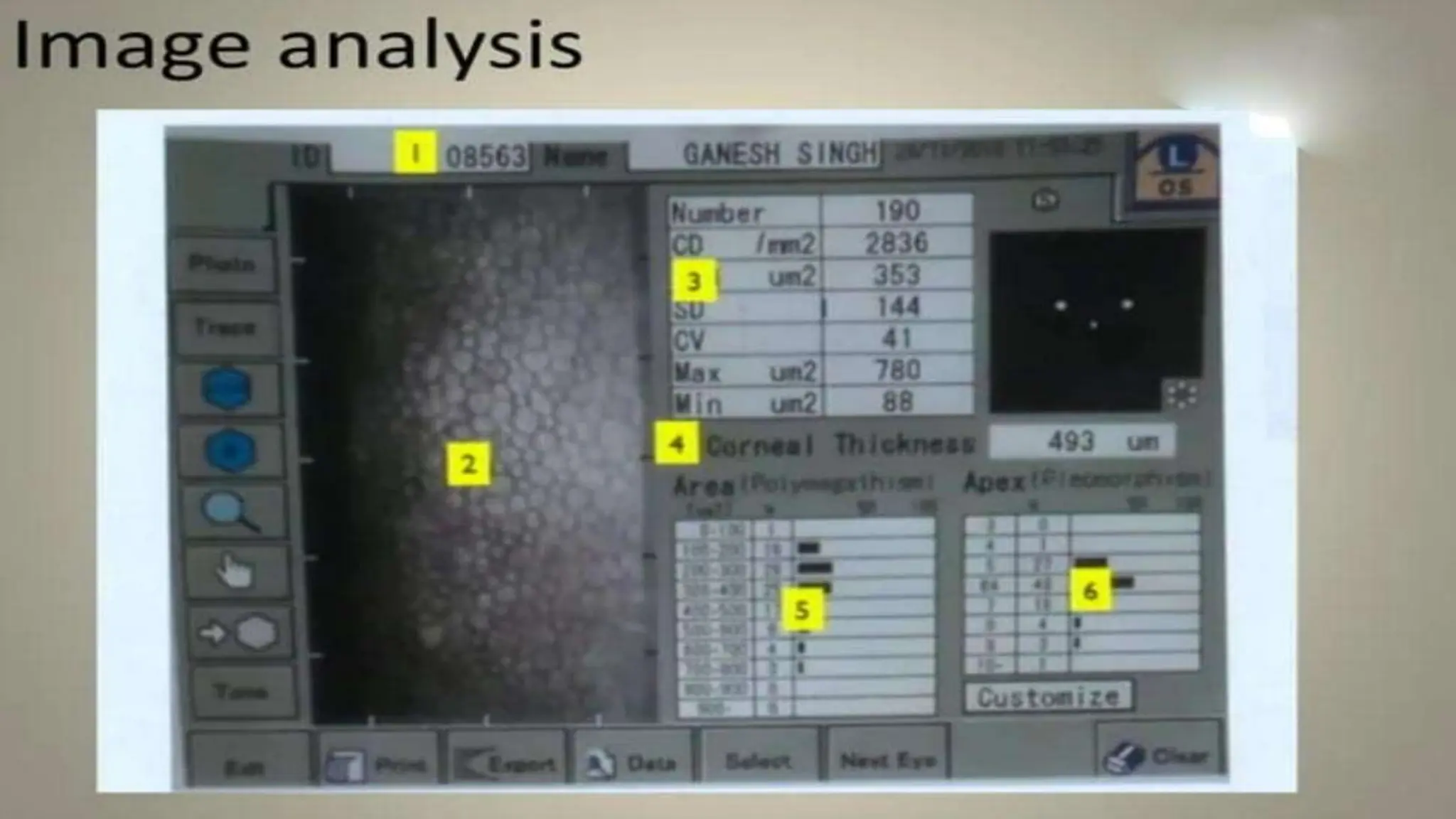 SPECULAR AND CONFOCAL MICROSCOPY IN EYE.pptx