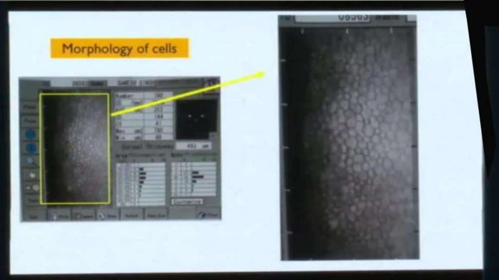 SPECULAR AND CONFOCAL MICROSCOPY IN EYE.pptx