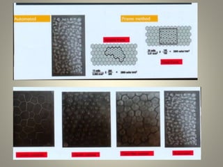 Specular microscopy | PPTX