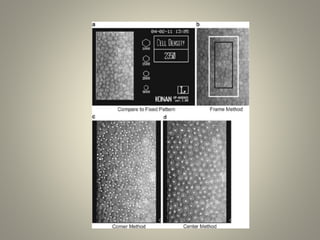 Specular microscopy | PPTX