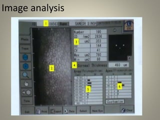 Specular microscopy | PPTX