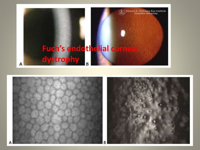 Specular microscopy | PPTX