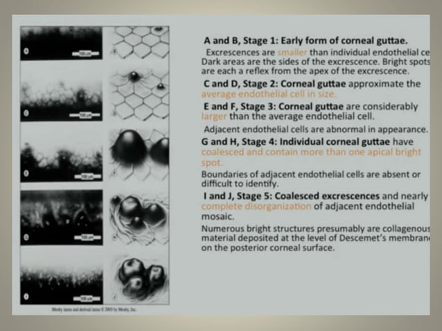 Specular microscopy | PPTX