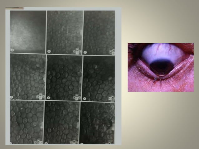 Specular microscopy | PPTX