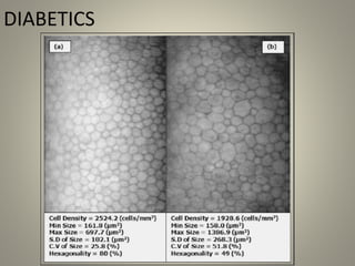 Specular microscopy | PPTX