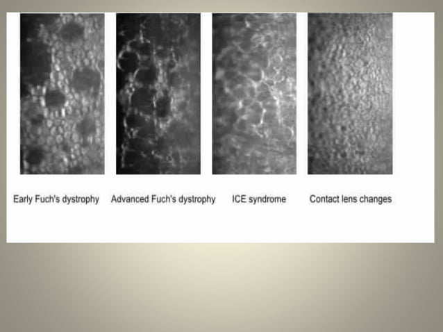 Specular microscopy | PPTX