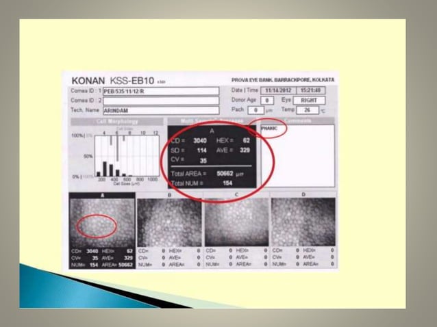 Specular microscopy | PPTX