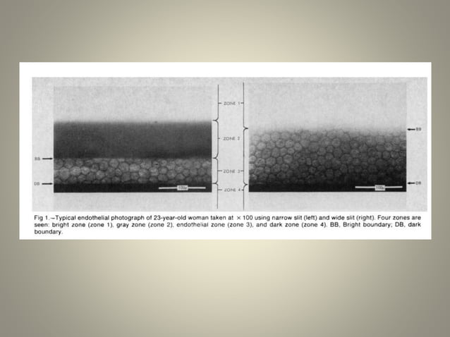 Specular microscopy | PPTX