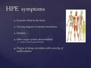 Holoprosencephaly | PPT