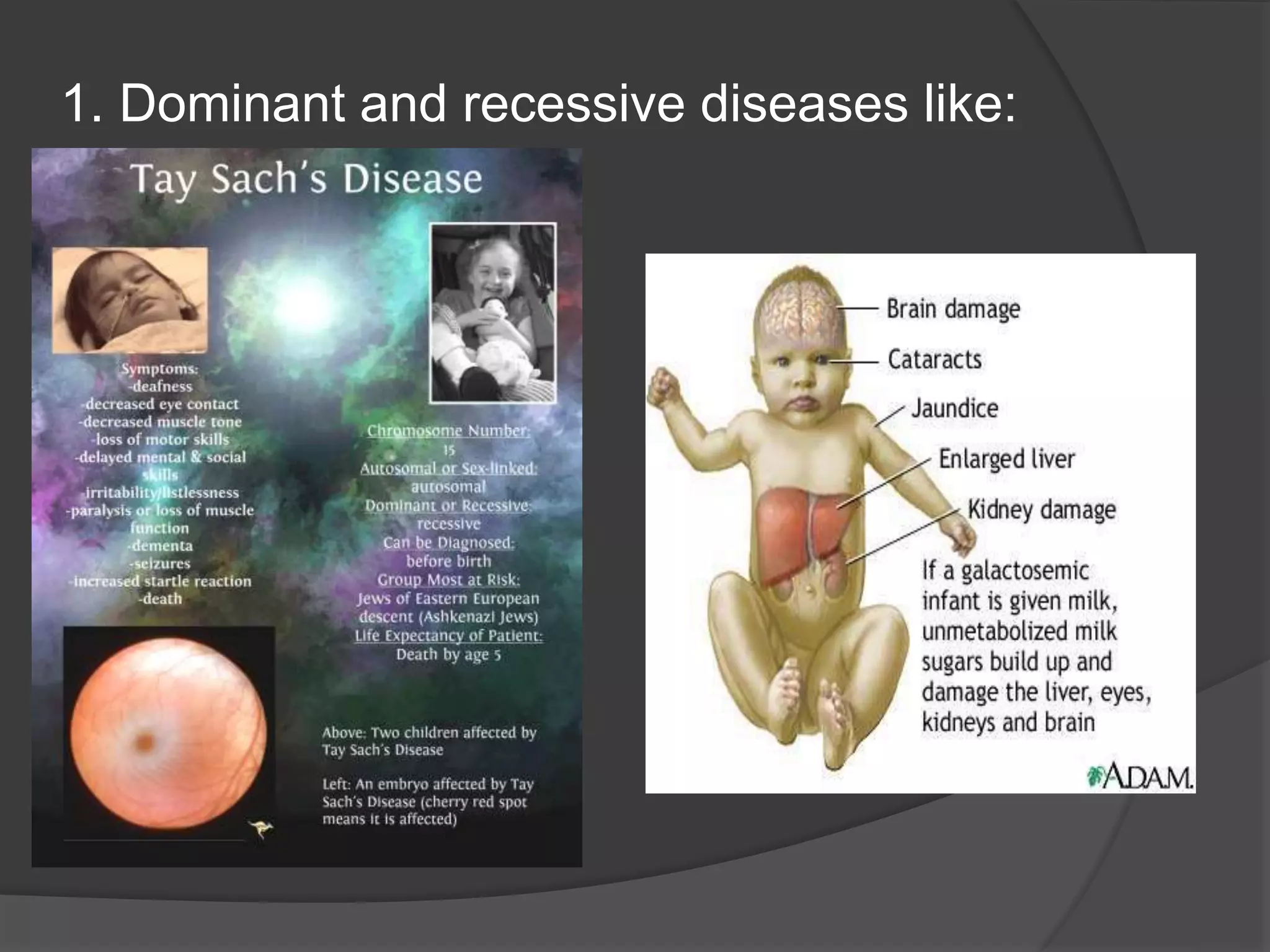 The Biological and environmental causes of Developmental Disabilities ...