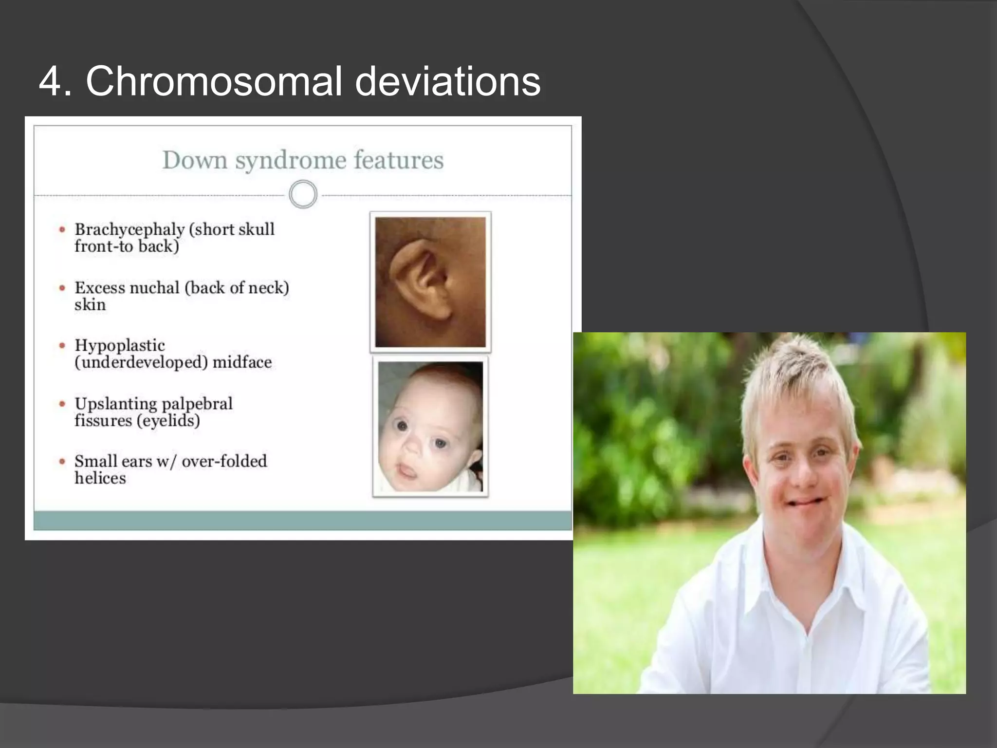 The Biological and environmental causes of Developmental Disabilities ...