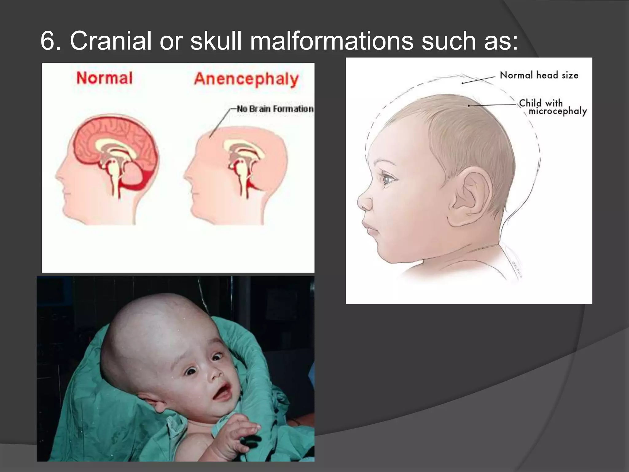The Biological and environmental causes of Developmental Disabilities ...