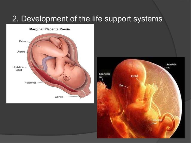 The Biological and environmental causes of Developmental Disabilities | PPT