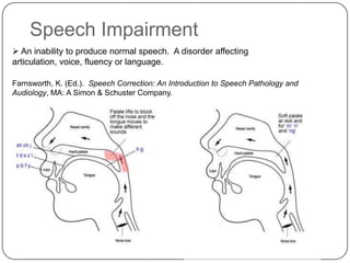 Speech And Language Disabilies | PPTX