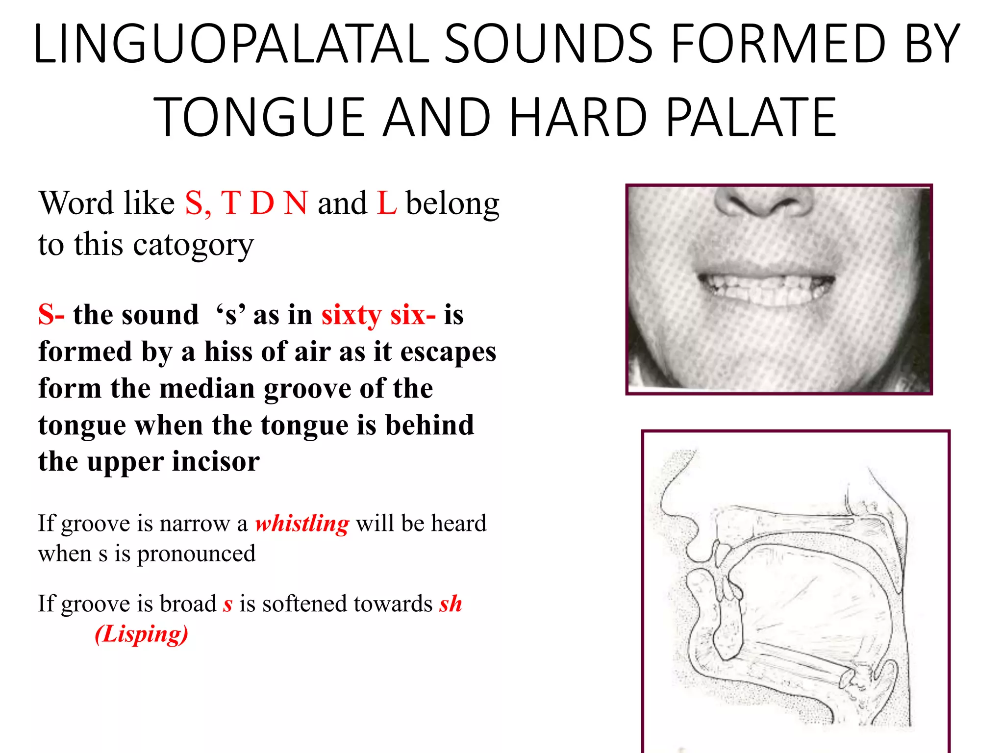 Speech consideration in complete denture | PPT