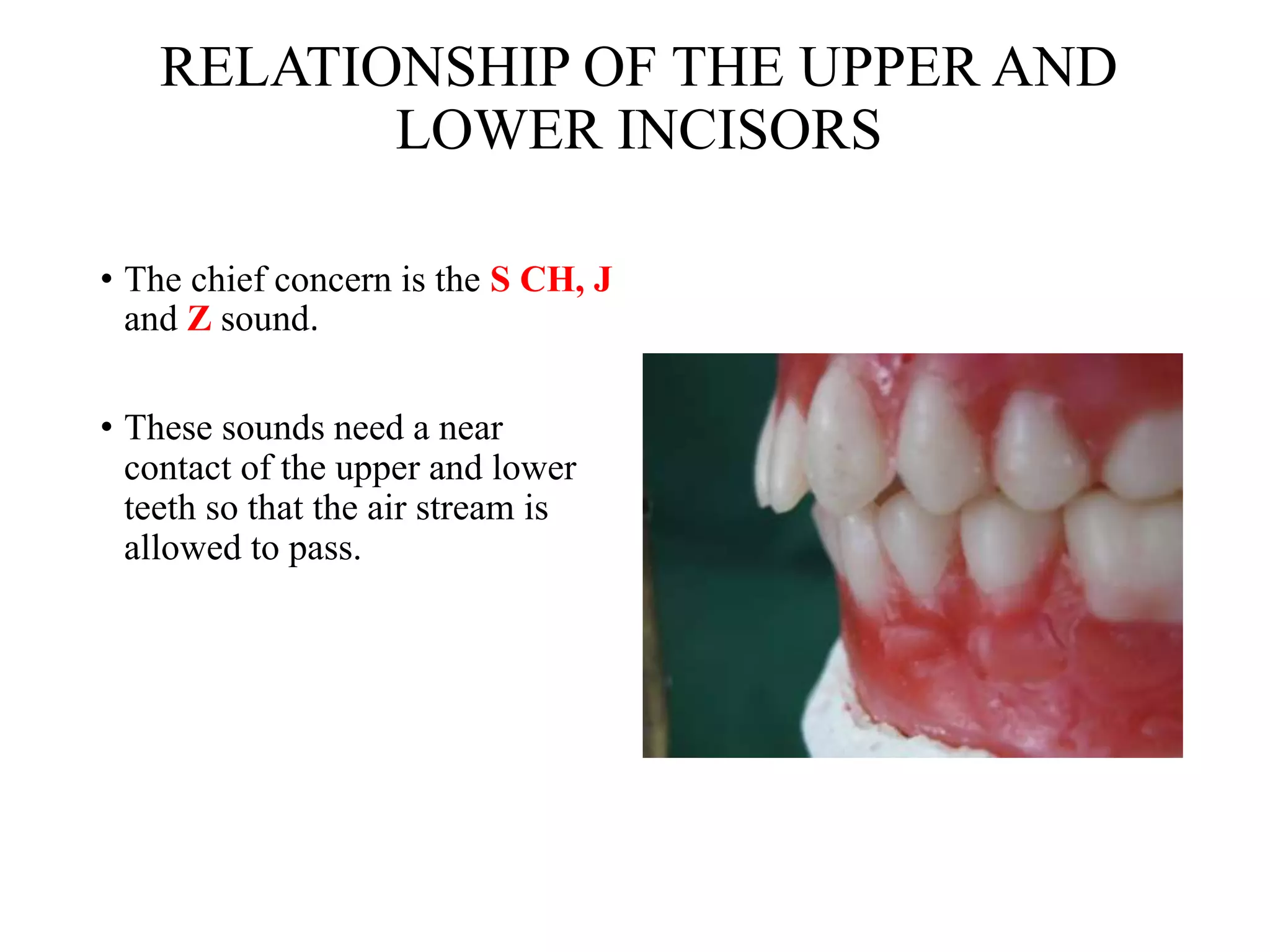Speech consideration in complete denture | PPT