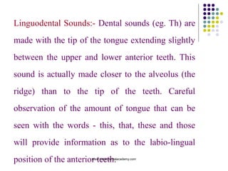 Speech considerations for cd/prosthodontic courses | PPT