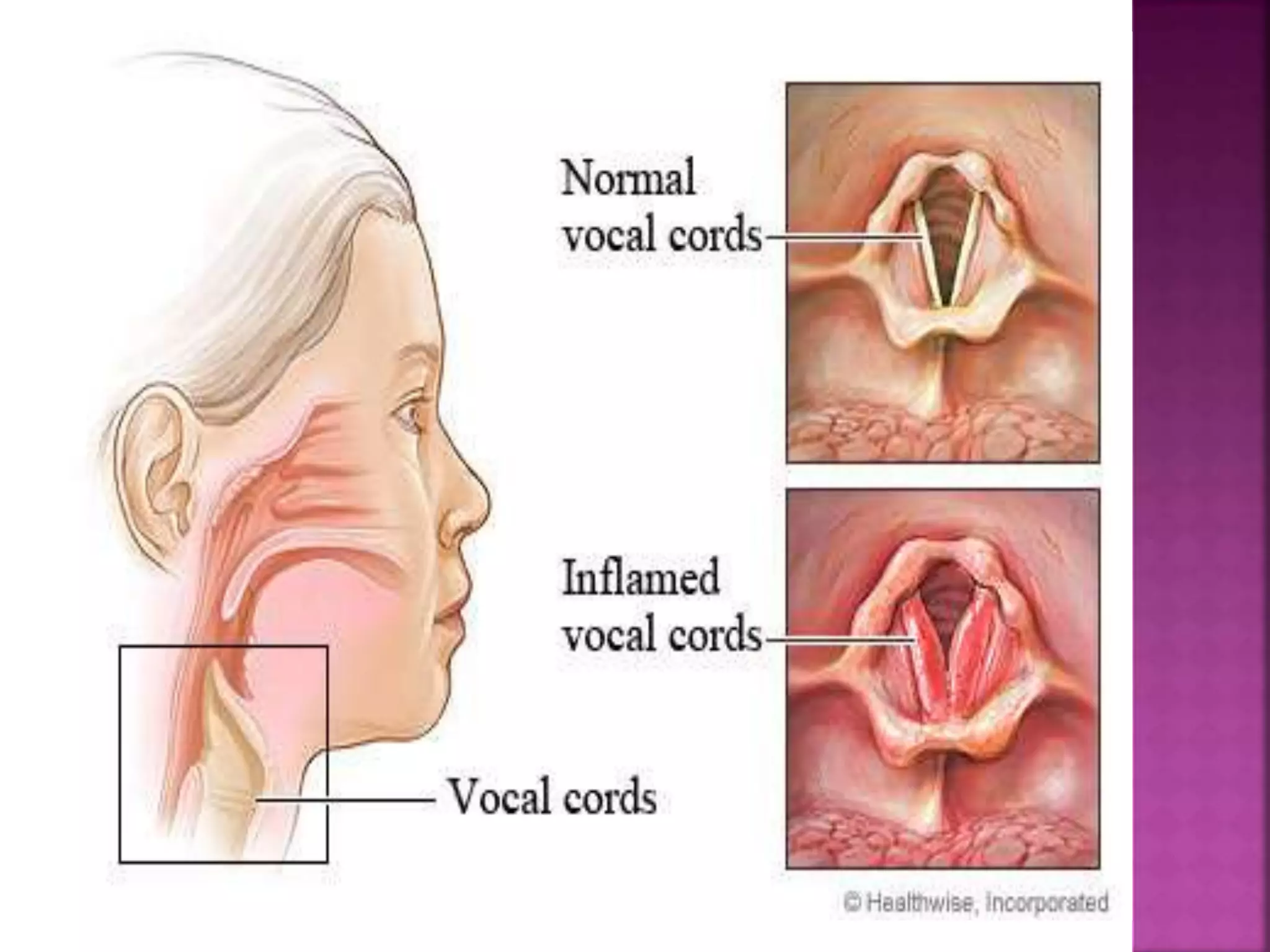 Speech defects and speech | PPTX