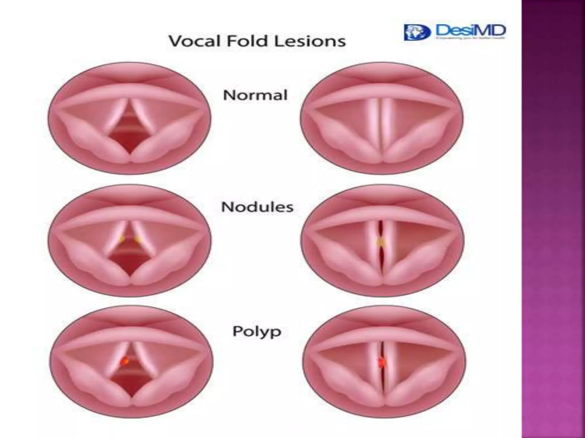 Speech defects and speech | PPTX