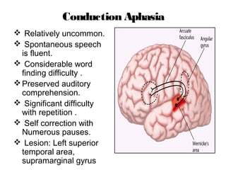 Speech disorder . | PPT