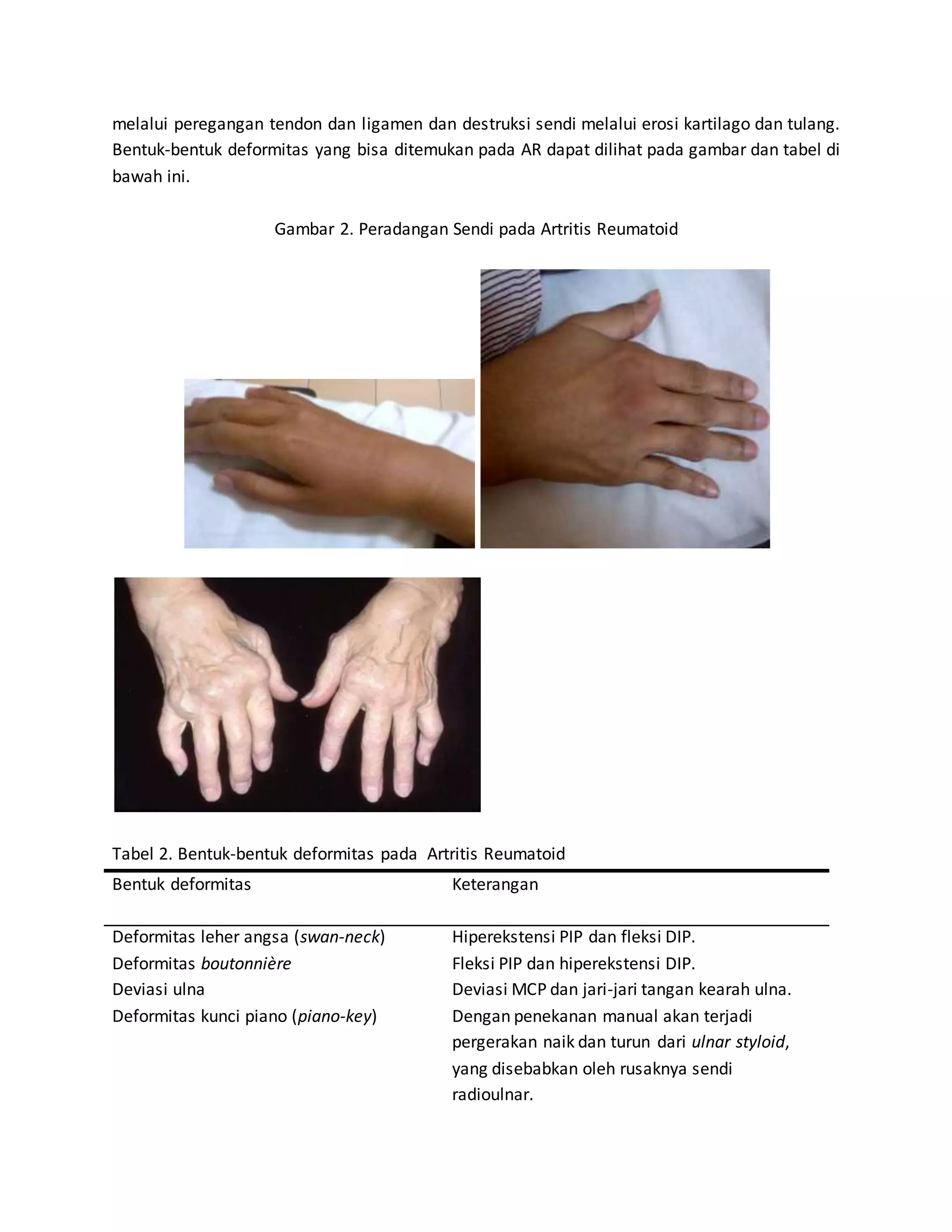 Spektrum klinis artritis reumatoid | DOCX