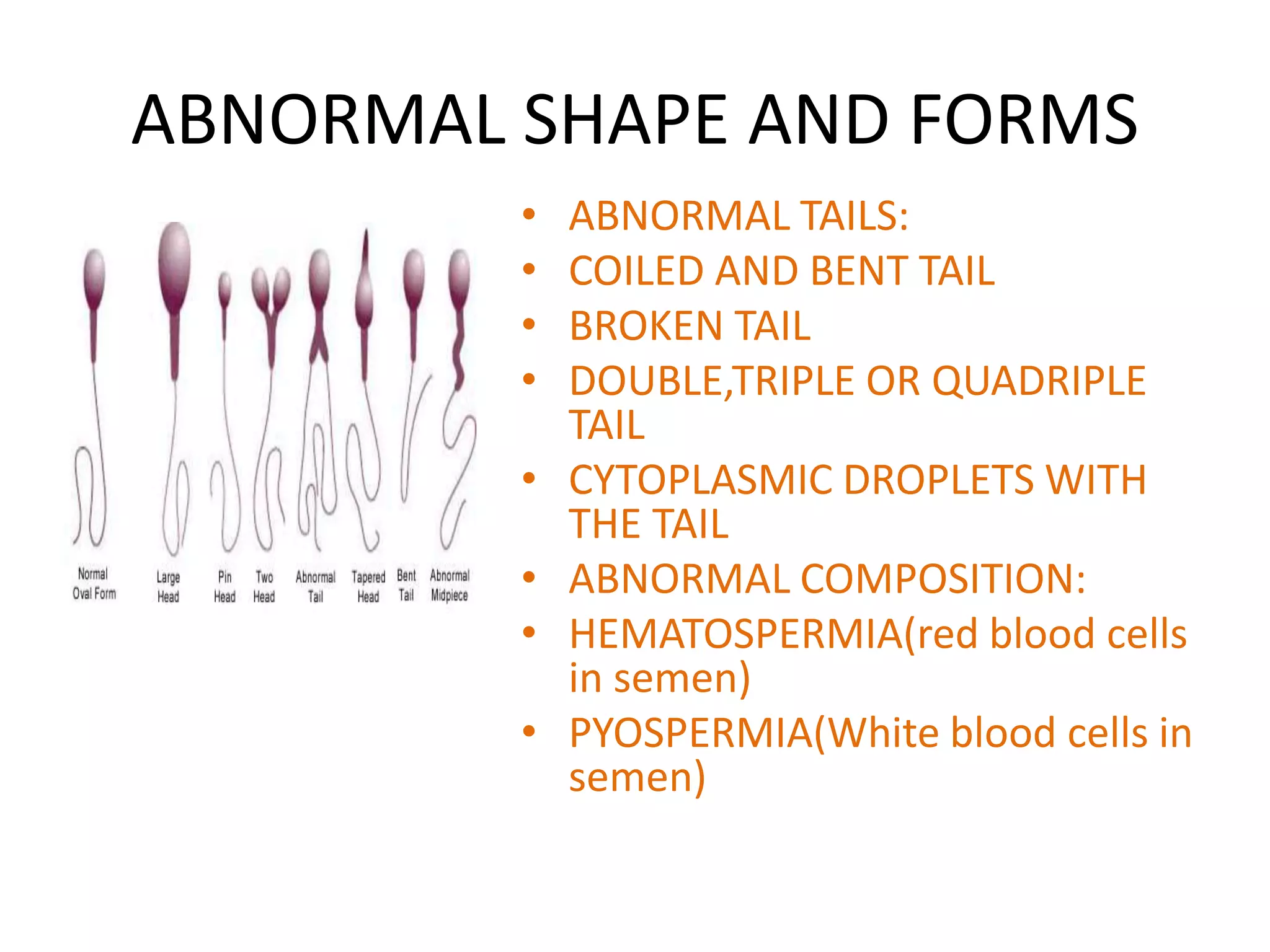 Sperm anatomy and physiology | PPTX